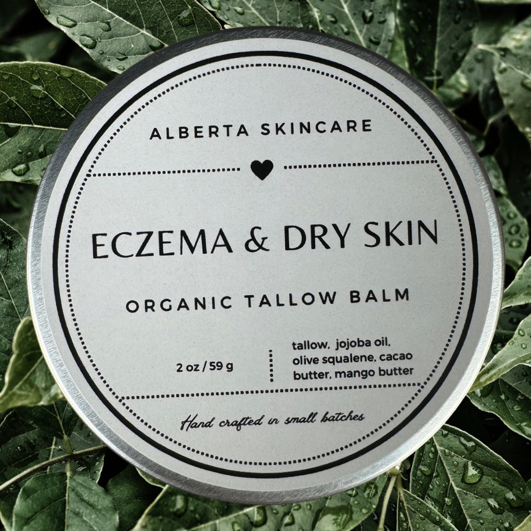 Eczema & Dry Skin Tallow Balm for sensitive skin.